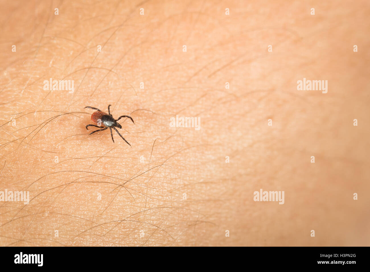 Tick - sucking carrier of various diseases Stock Photo - Alamy