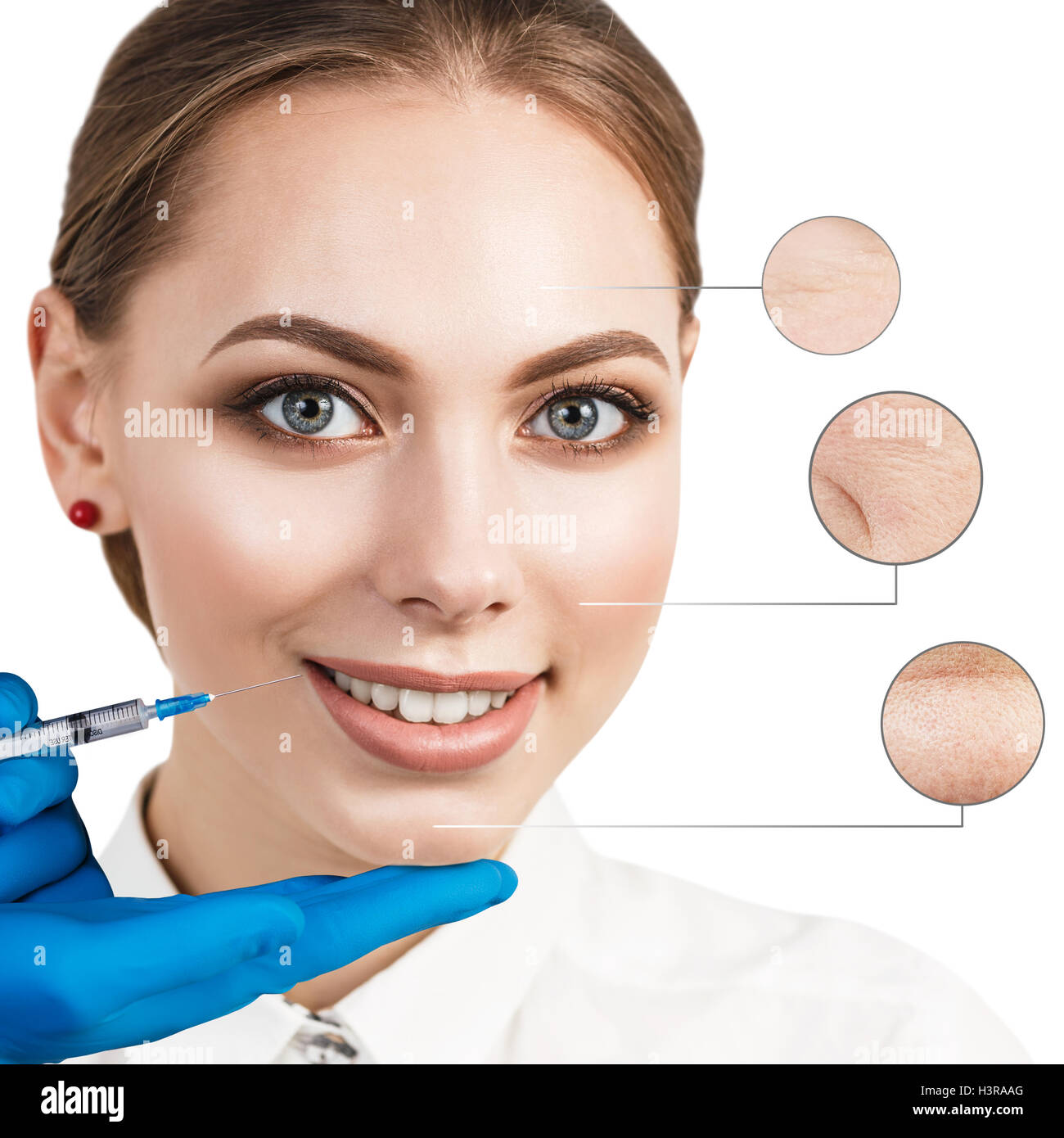 Cosmetic injection to the pretty female face with zoom circles ...