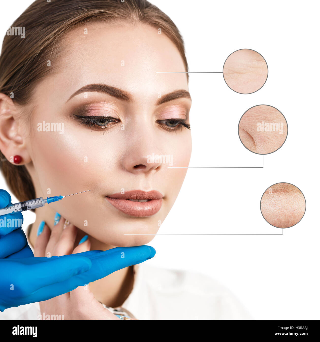 Cosmetic injection to the pretty female face with zoom circles ...