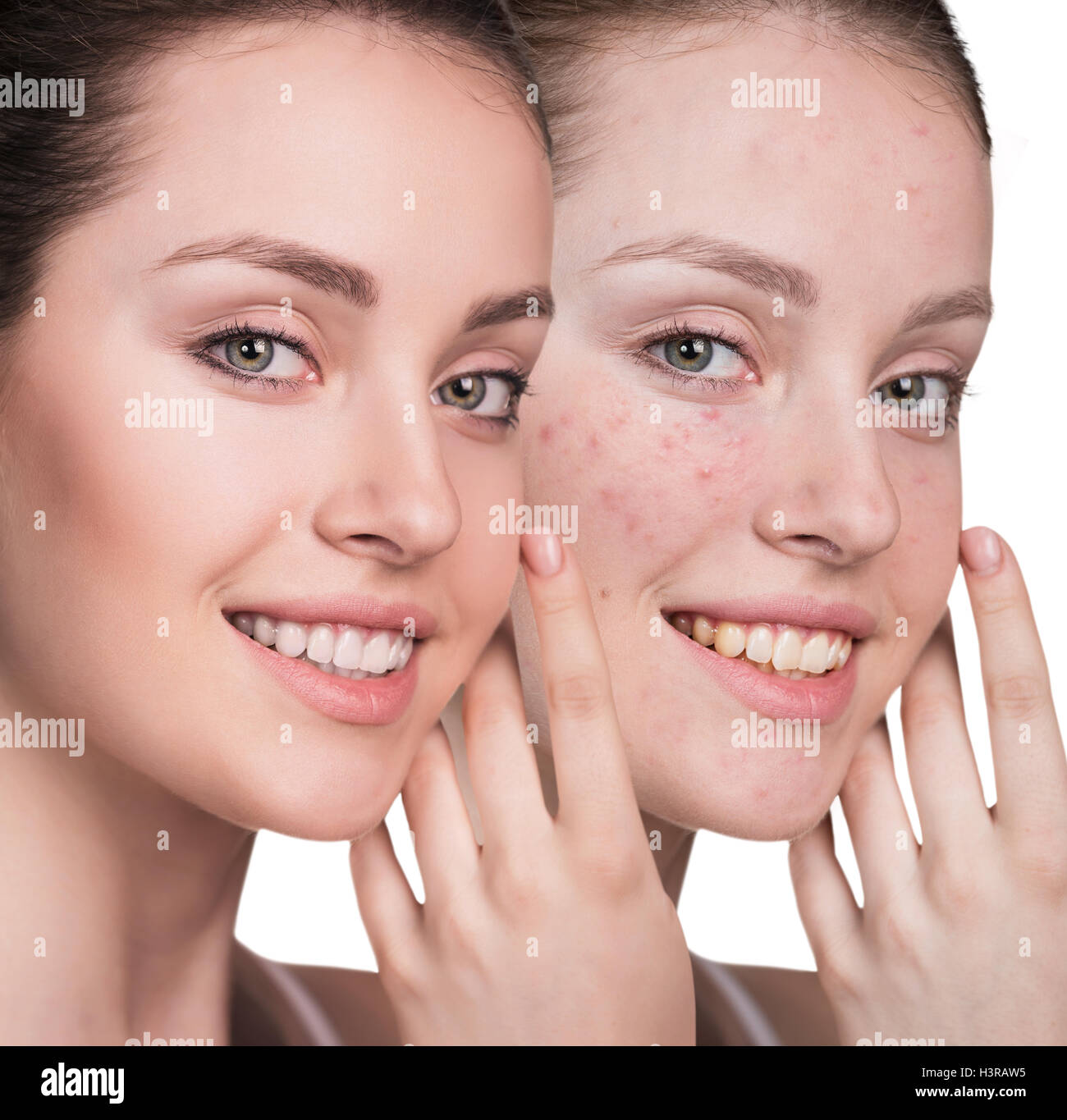 Skin woman hi-res stock photography and images - Alamy