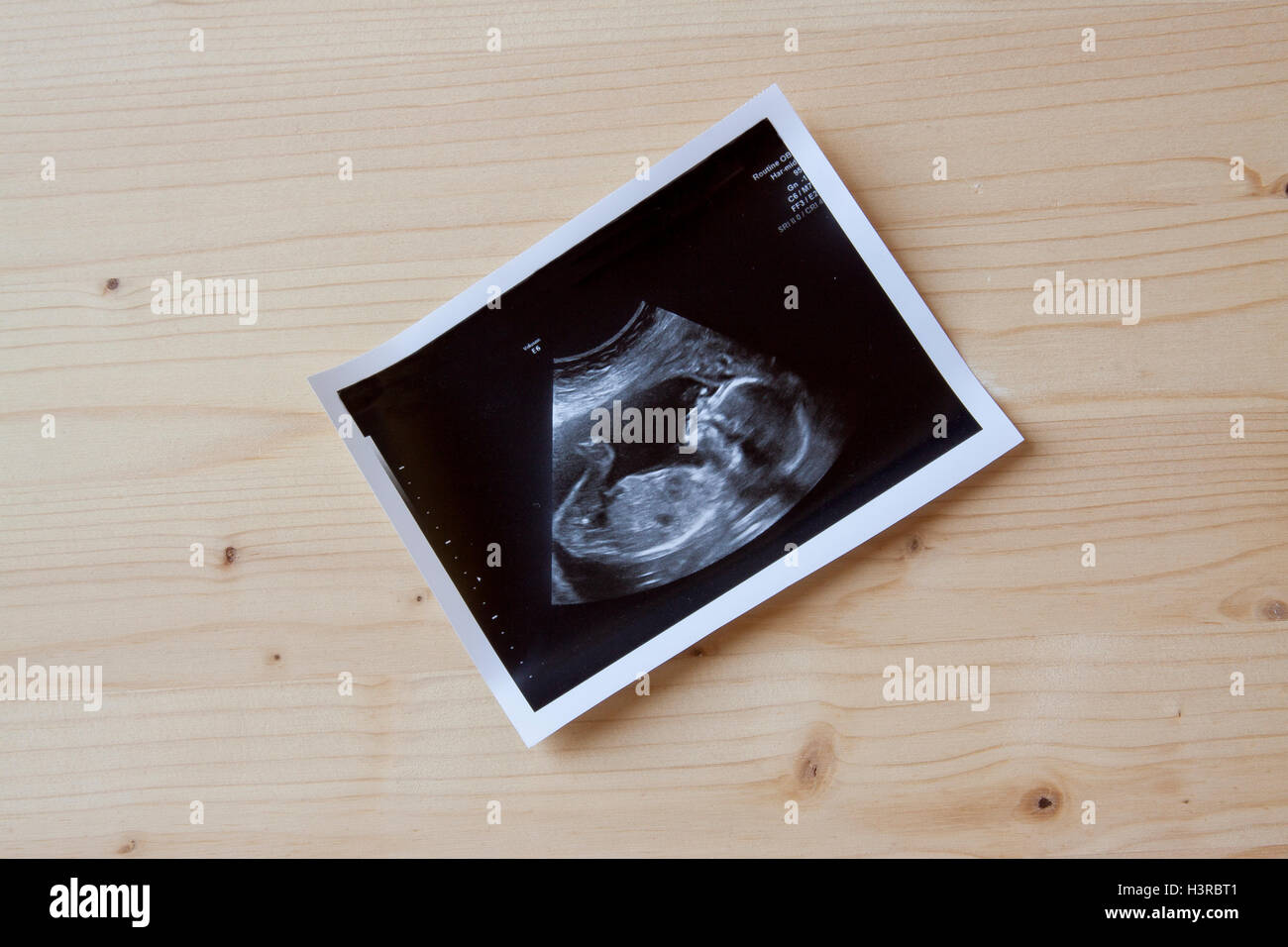 Sonogram of a small baby on a wooden background Stock Photo - Alamy