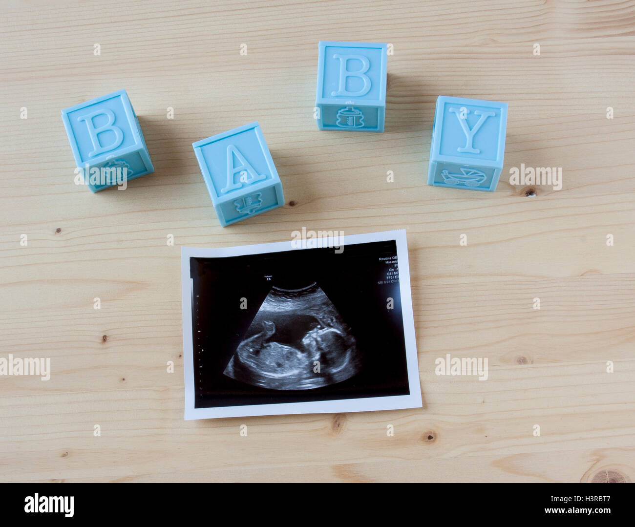 Ultrasound image of a baby hi-res stock photography and images - Alamy