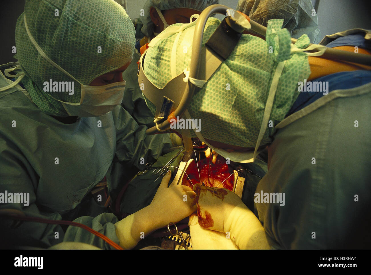 Op. hall, surgeon, heart operation, hospital, OP., doctors, op. team ...