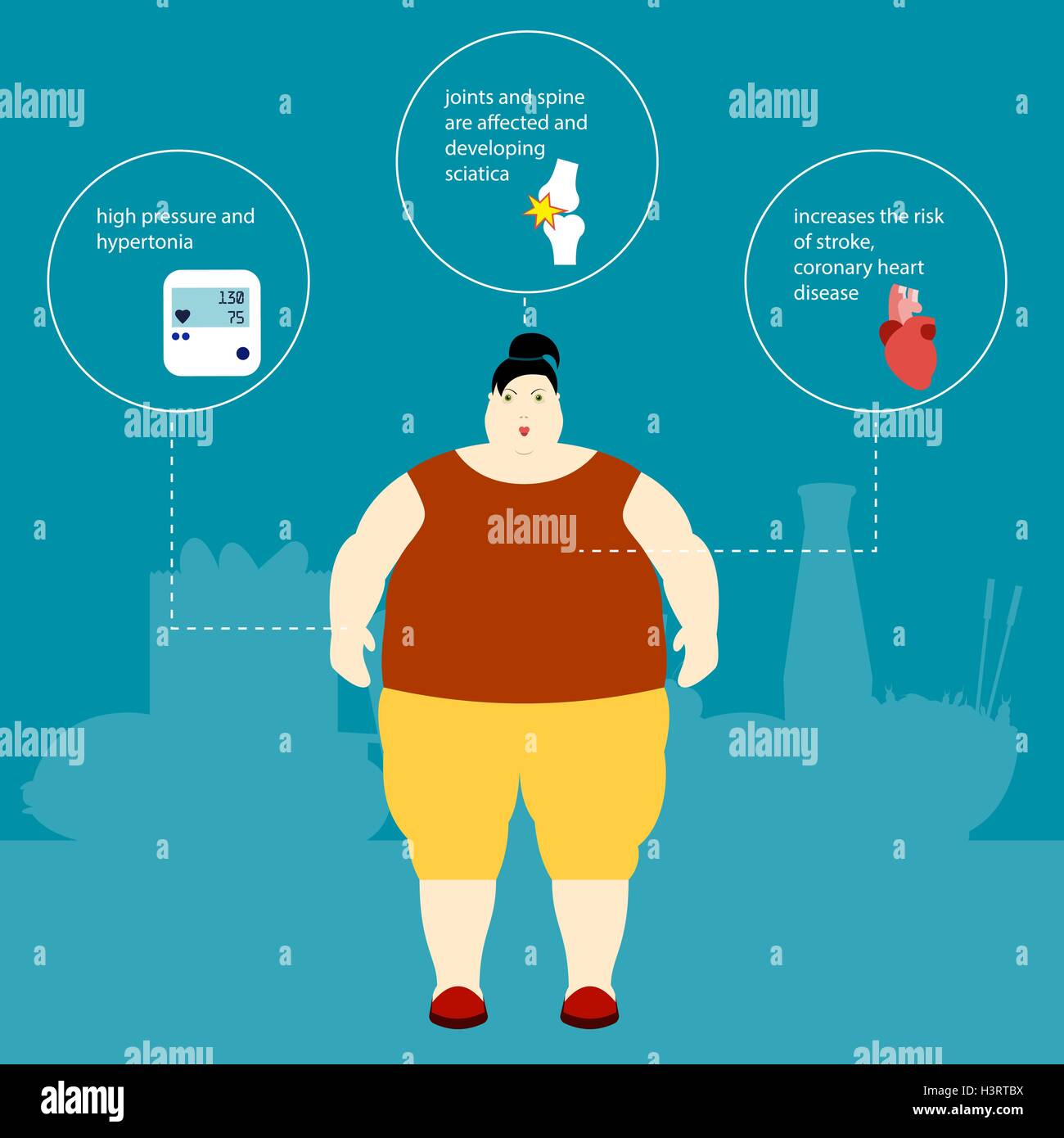 Obesity Vector illustration Stock Vector Image & Art - Alamy