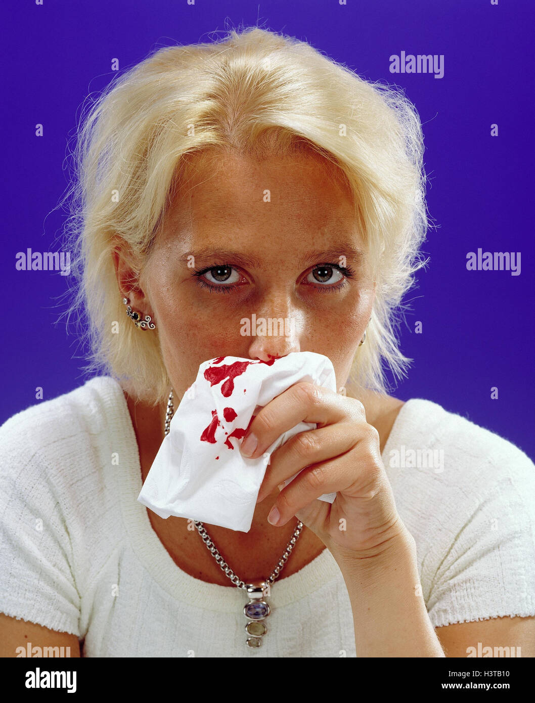 Nose Bleeding Epistaxis Stock Photos & Nose Bleeding Epistaxis Stock ...