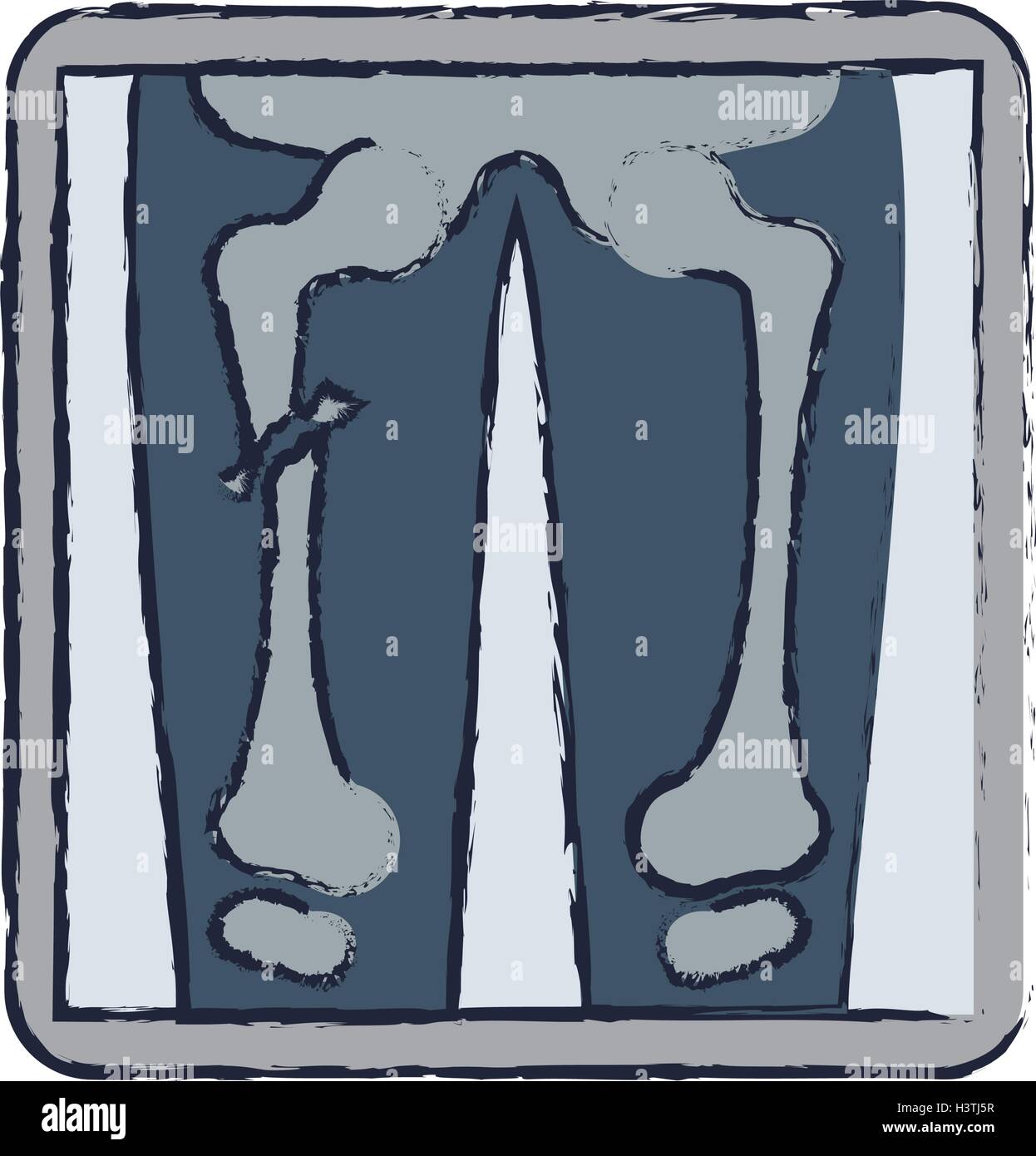 blur screen with x-ray of bones Stock Vector Image & Art - Alamy