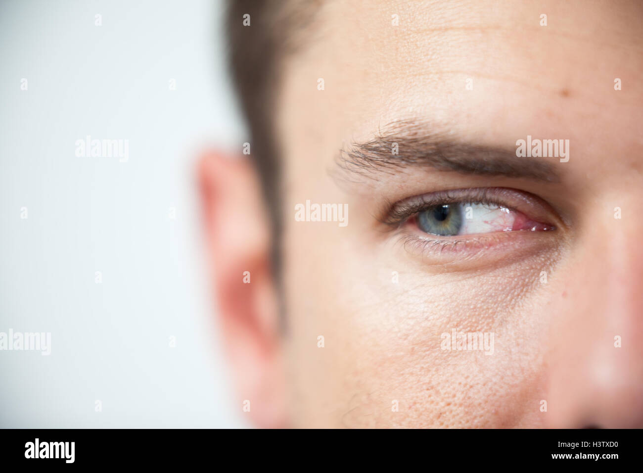 Man wearing contact lens Stock Photo - Alamy