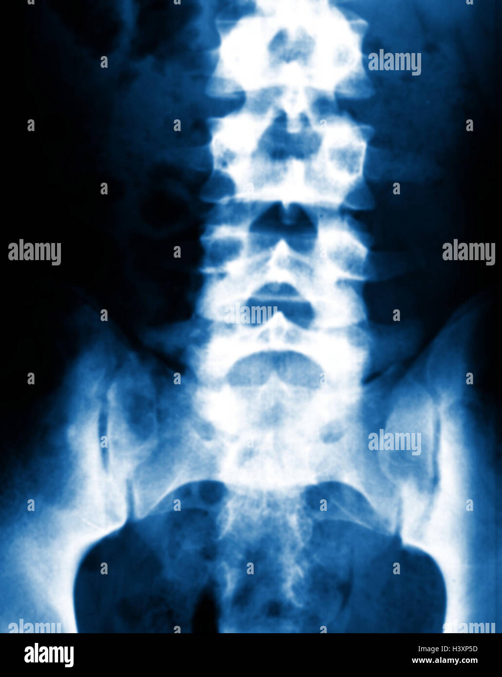 X ray examination roentgenogram hi-res stock photography and images - Alamy