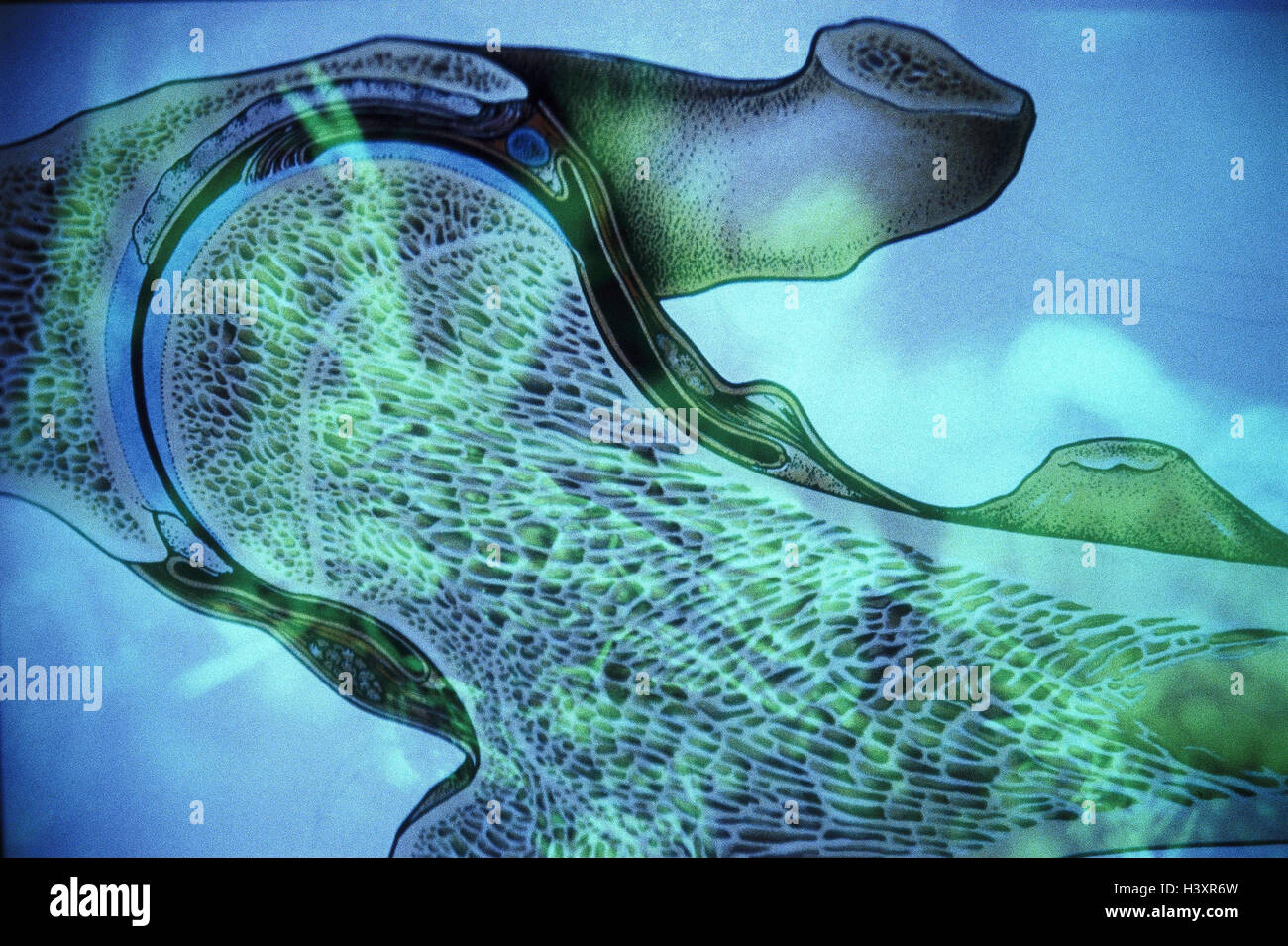 Representation, osteoporosis, raised fracture susceptibility, person ...