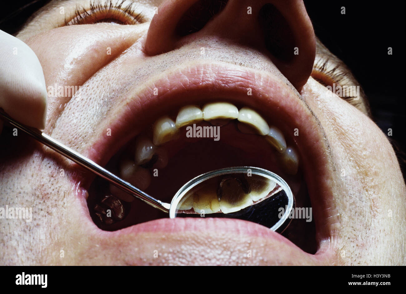 Dentist, patient, examination, oral reflector, close up model released ...