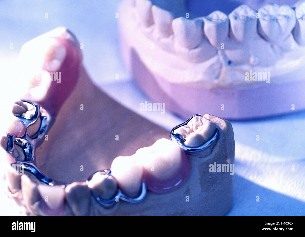 Cog technology, set dentures, gypsum model, part prosthesis, dentist ...