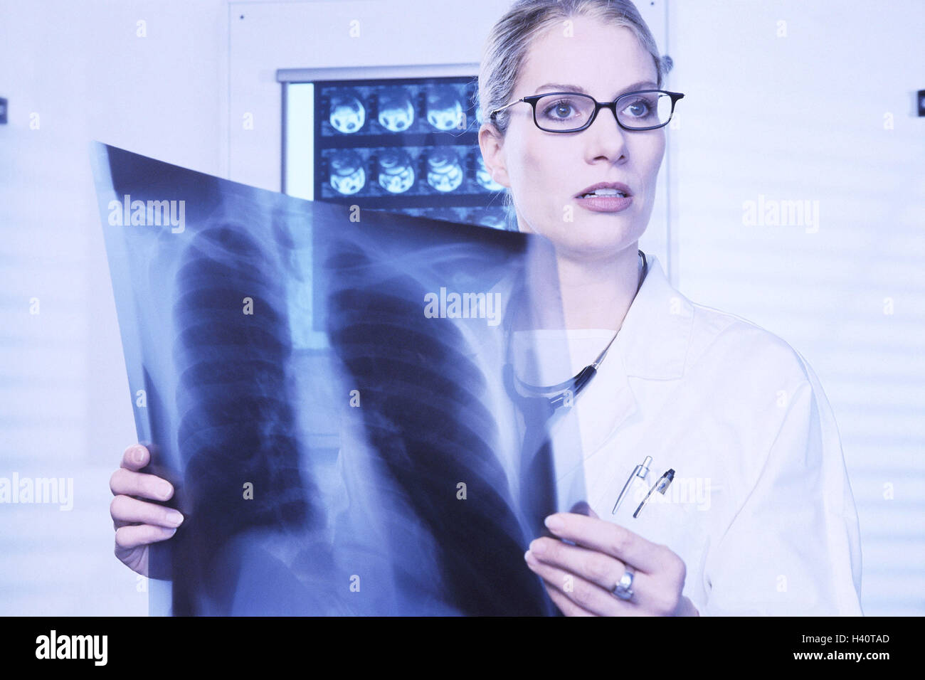 Doctor with roentgenogram hi-res stock photography and images - Alamy