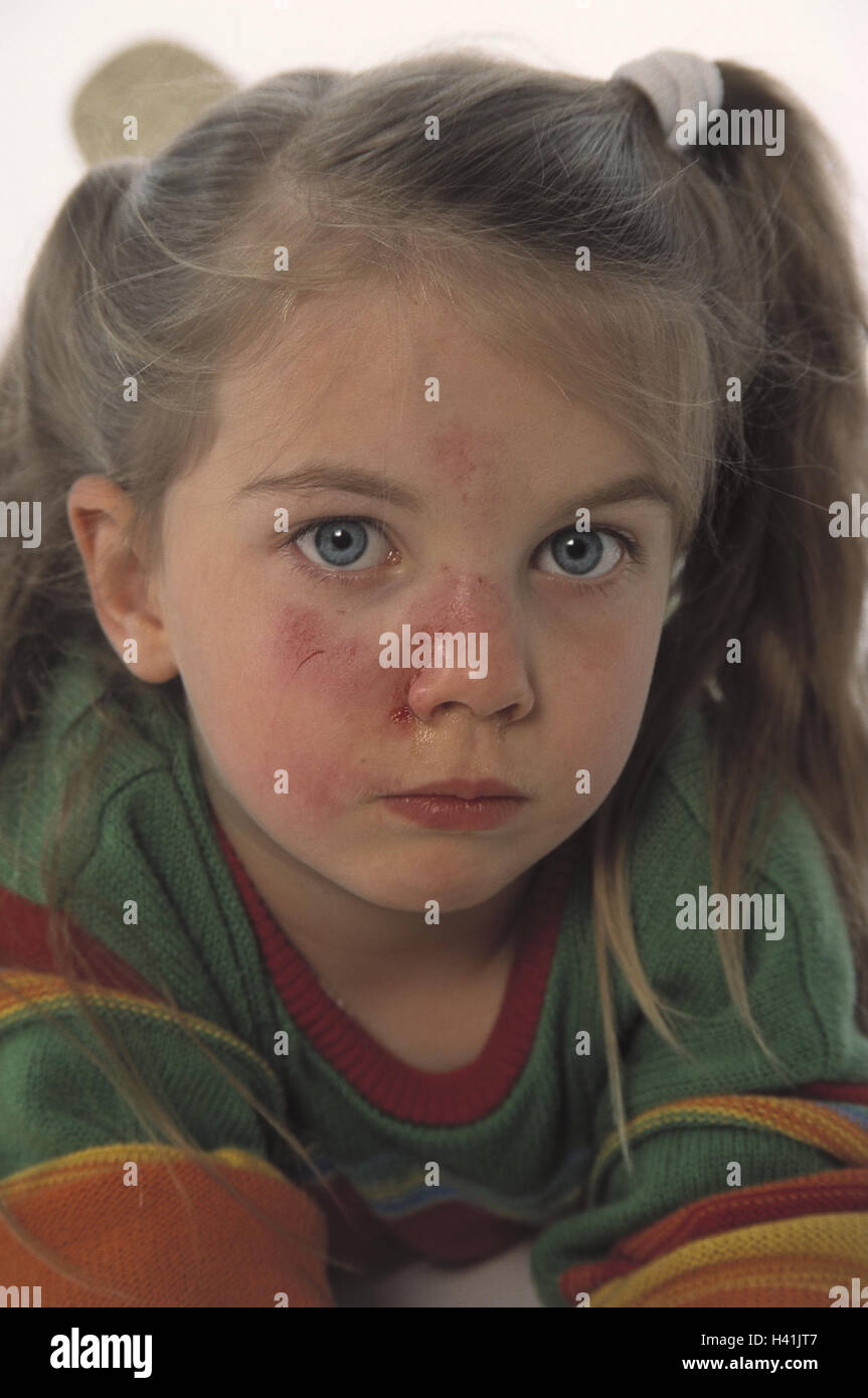 Girl, look, injury, portrait, child, injures, graze, facial injury ...