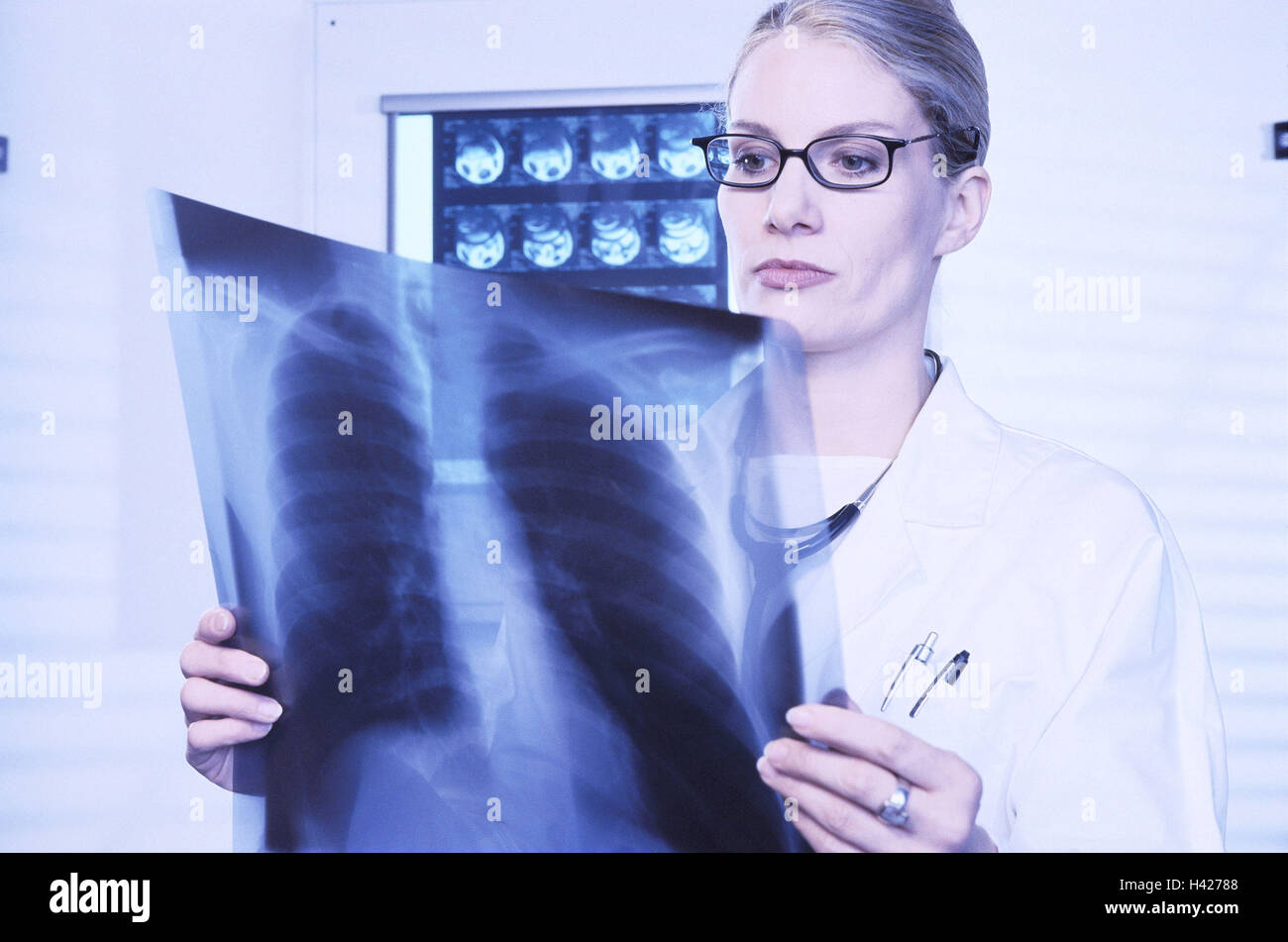 At doctor, seriously, roentgenogram, look, diagnostic, portrait ...