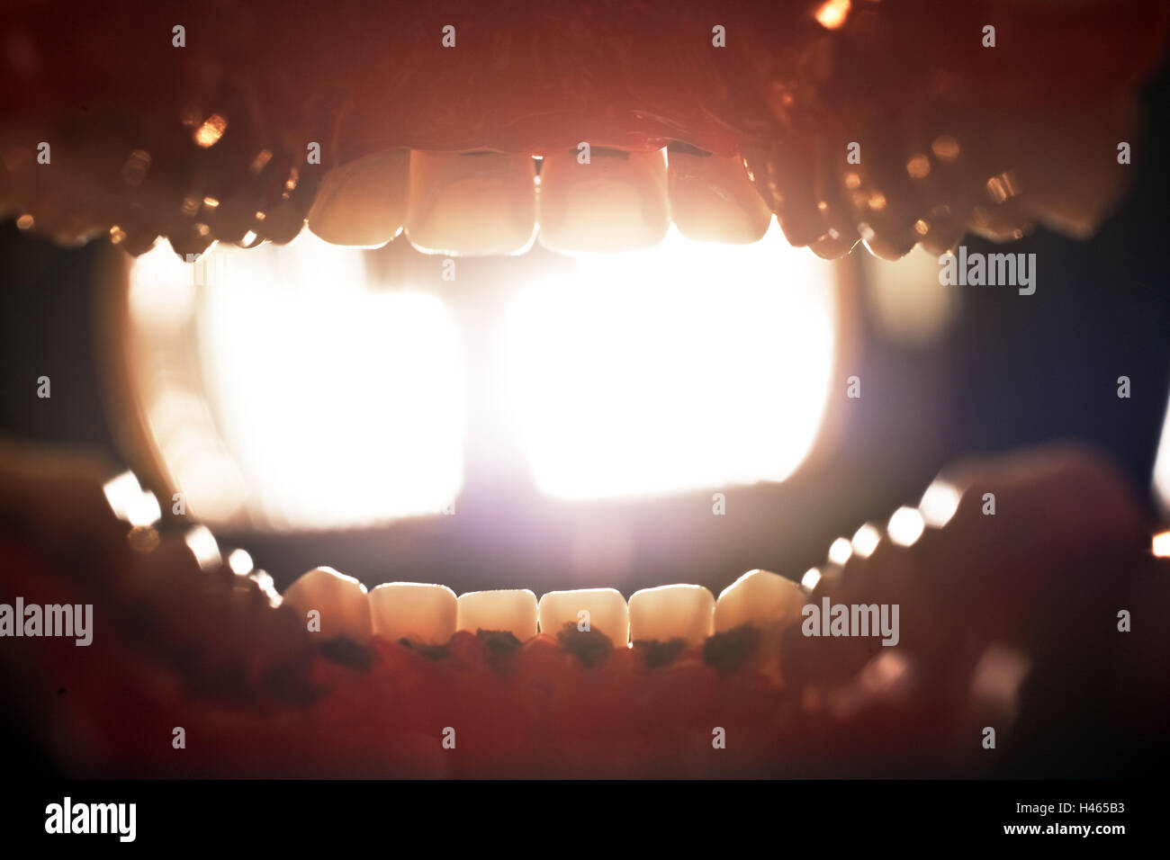 Dentist, mouth, openly, cogs, lamp, perspective, oral cavity Stock ...