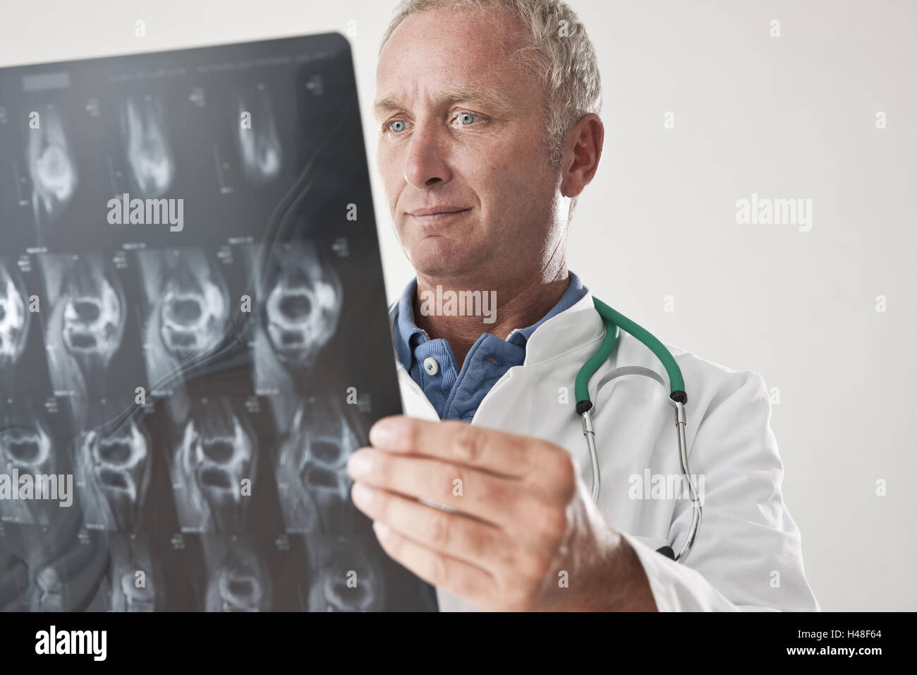 Doctor checks radiograph Stock Photo - Alamy