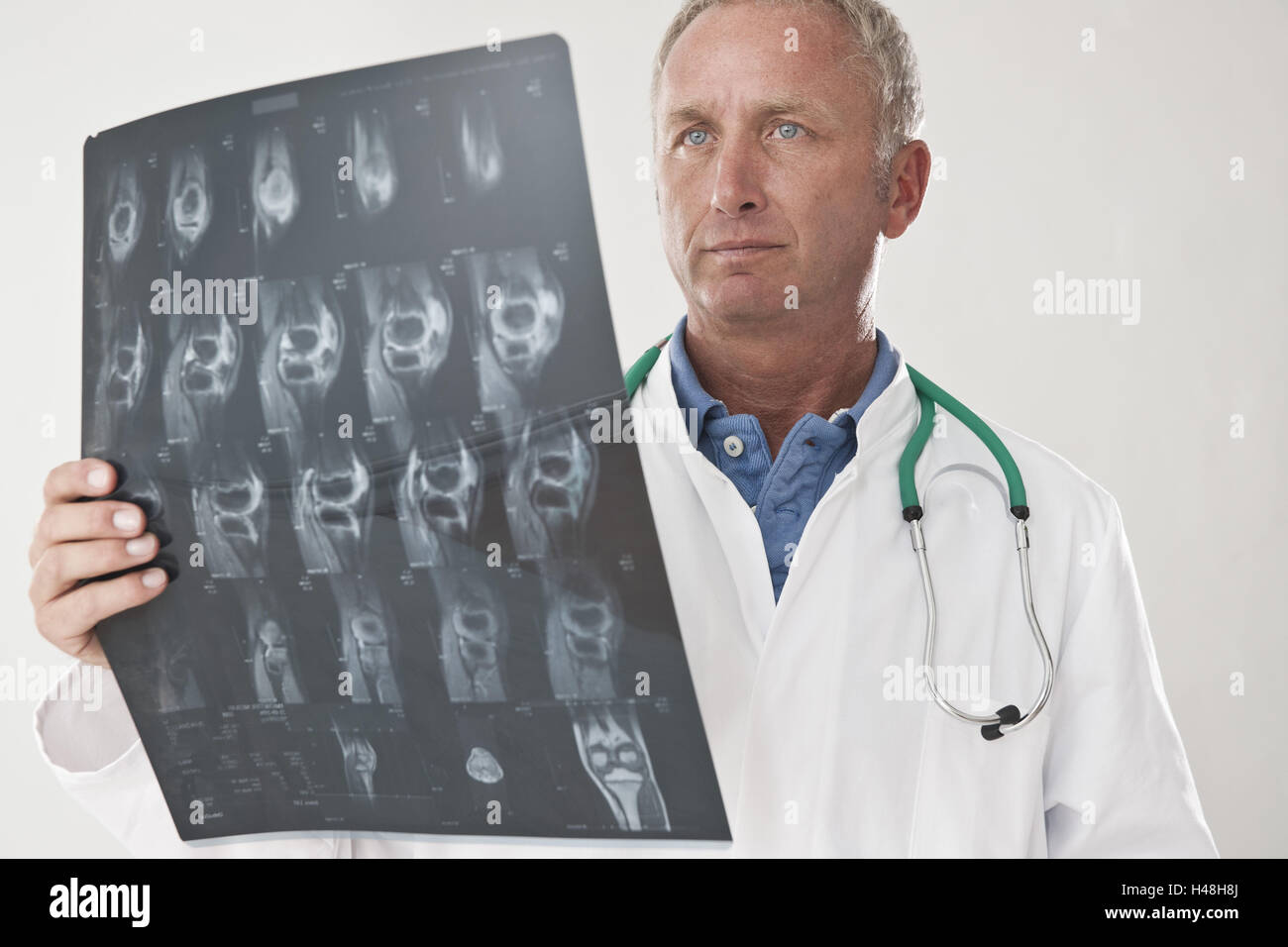 Doctor checks roentgenogram Stock Photo - Alamy