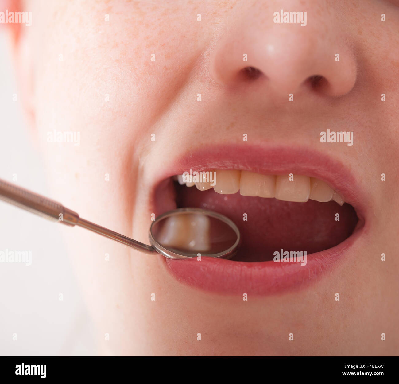 Check the teeth Stock Photo - Alamy