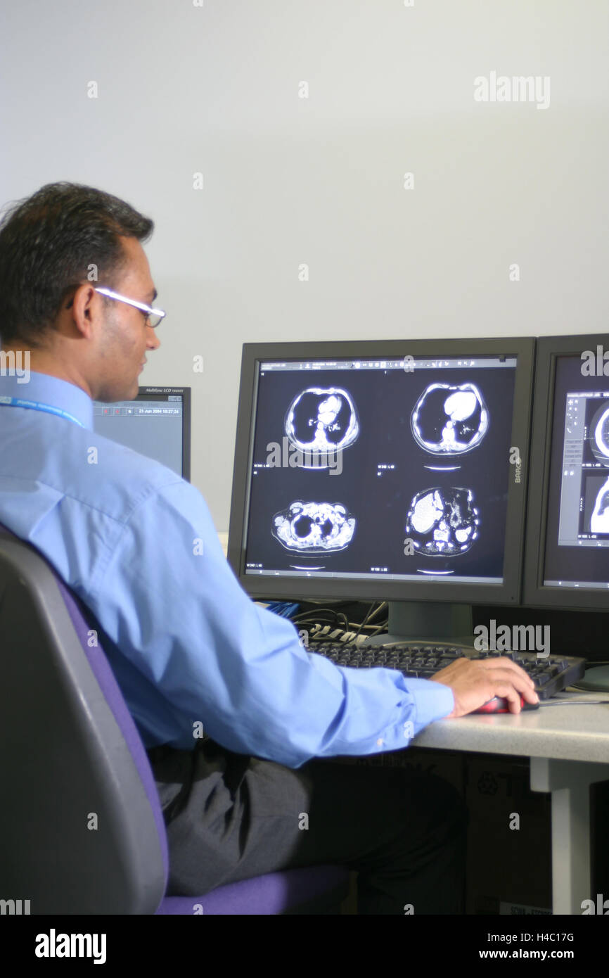 Nhs mri scan brain hi-res stock photography and images - Alamy