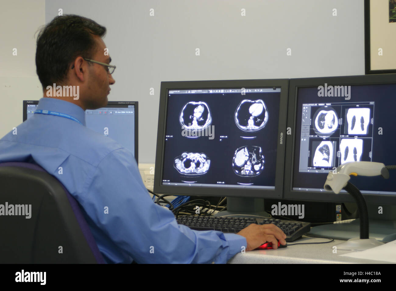 Nhs mri scan brain hi-res stock photography and images - Alamy
