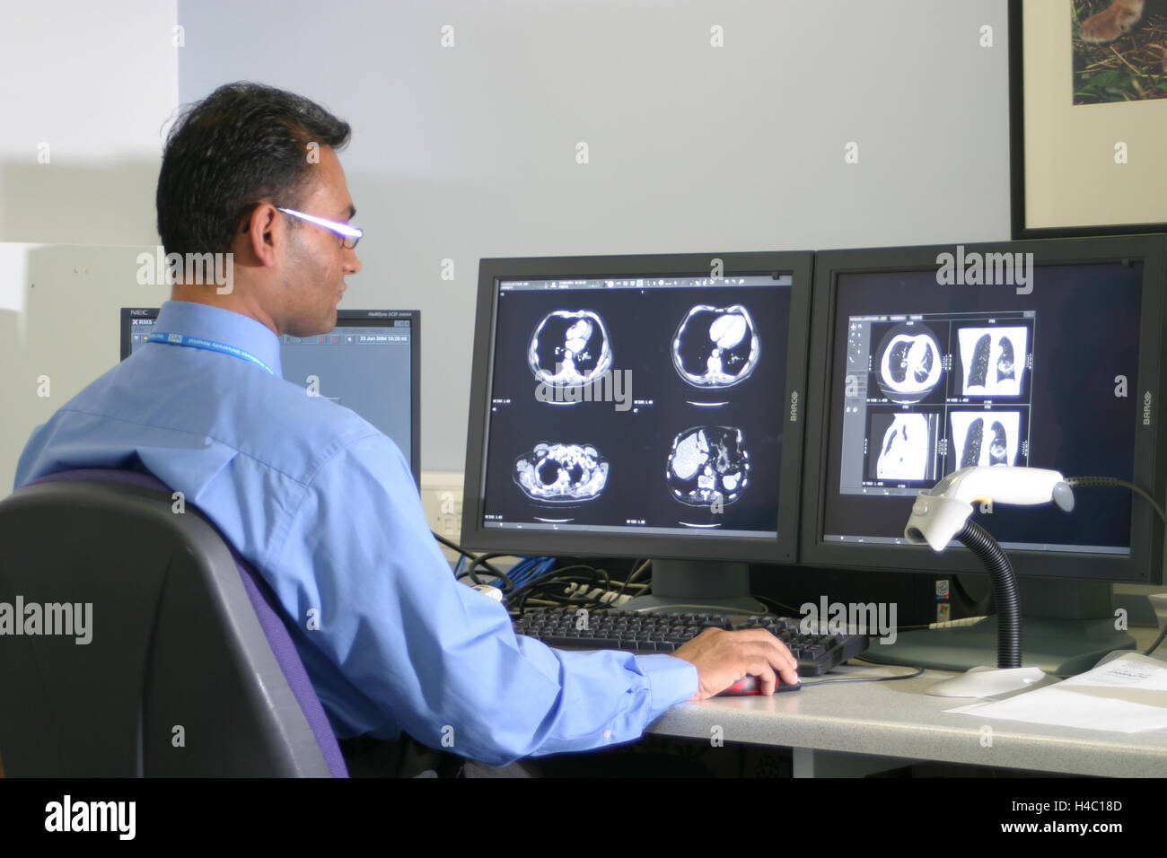 A doctor examines digital images from a hospital MRI scanner (patient ...