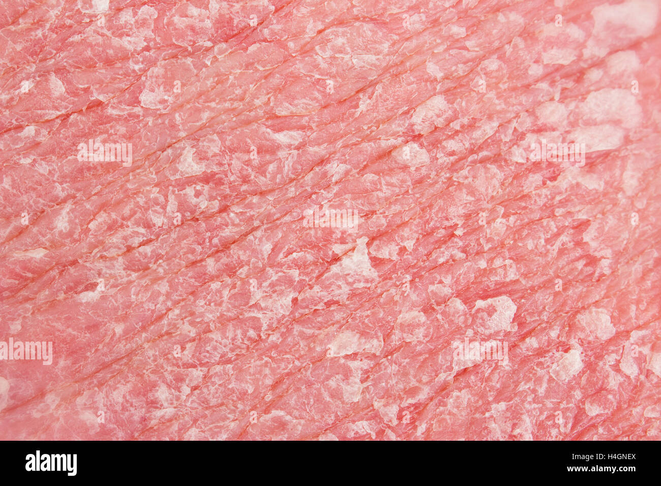 Dry Scaly Skin High Resolution Stock Photography and Images - Alamy