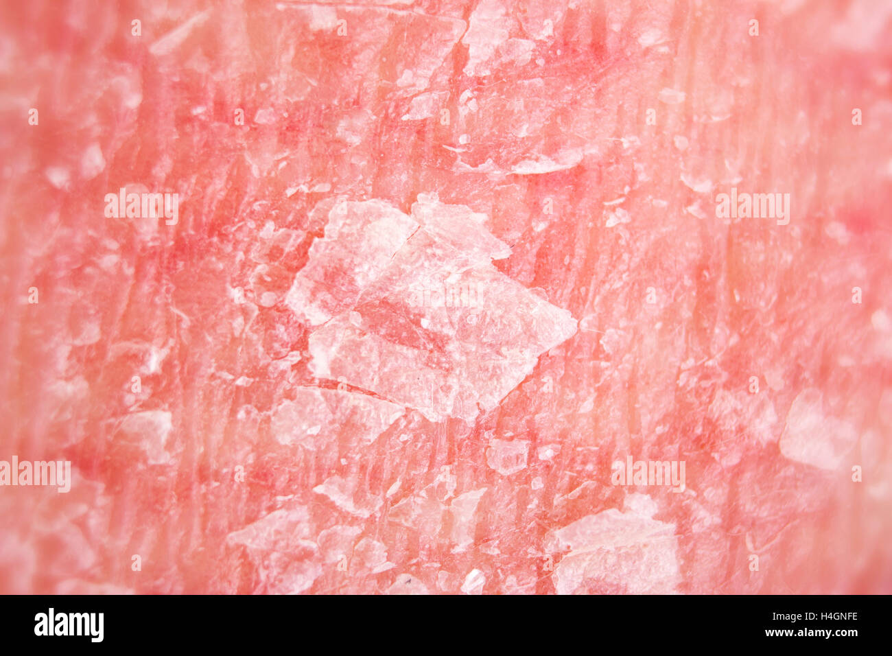 Dry Scaly Skin High Resolution Stock Photography and Images - Alamy