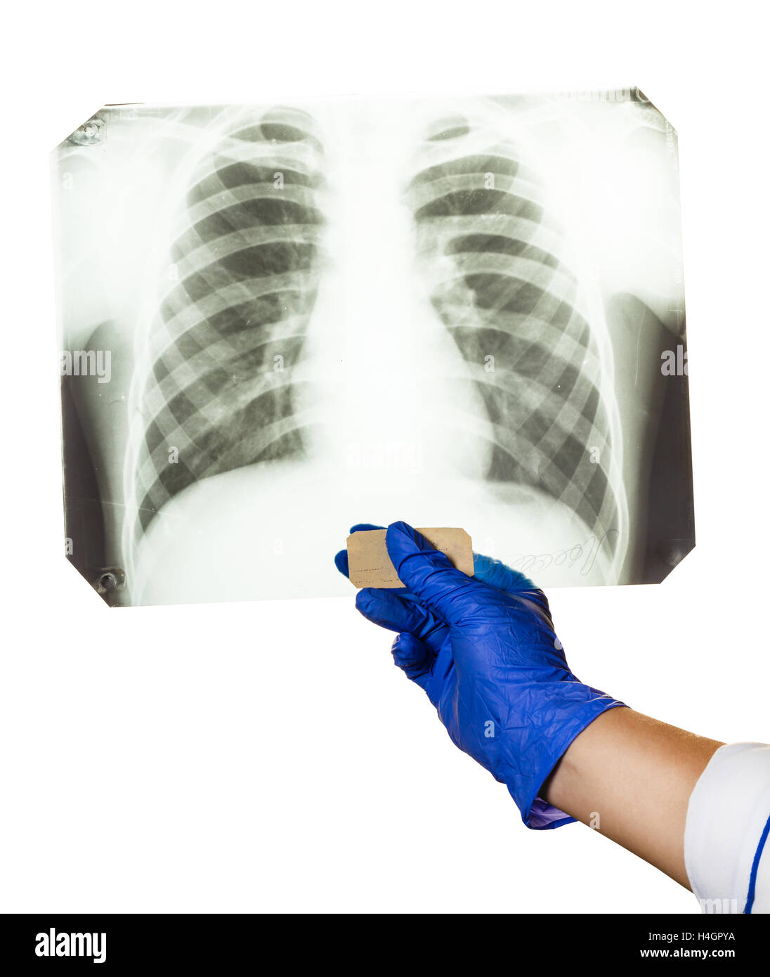 Woman chest x ray hi-res stock photography and images - Alamy