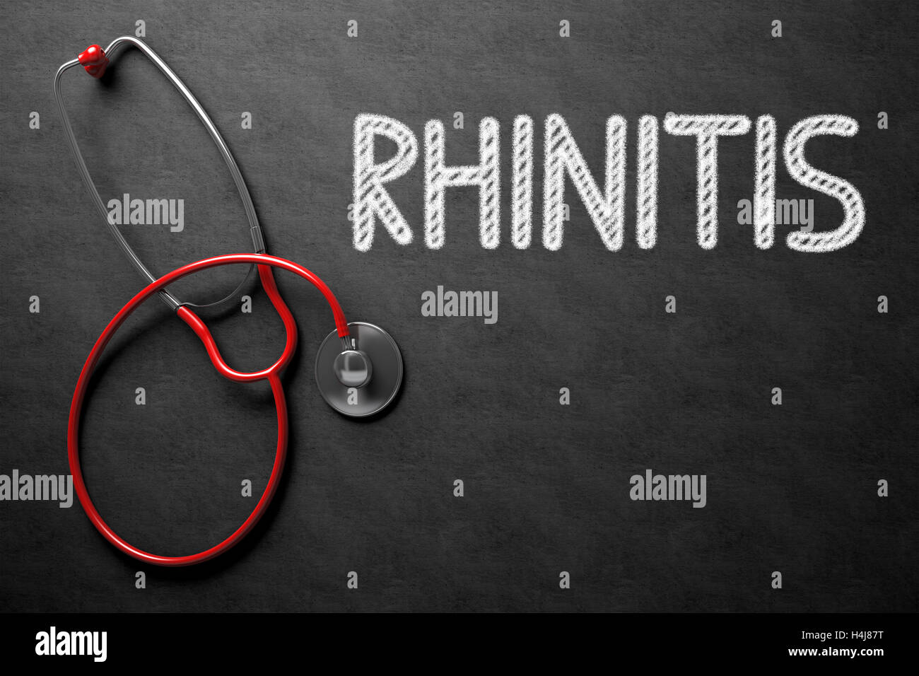 Rhinitis Handwritten on Chalkboard. 3D Illustration Stock Photo - Alamy Rhinitis Handwritten on Chalkboard. 3D Illustration Stock Photo - Alamy