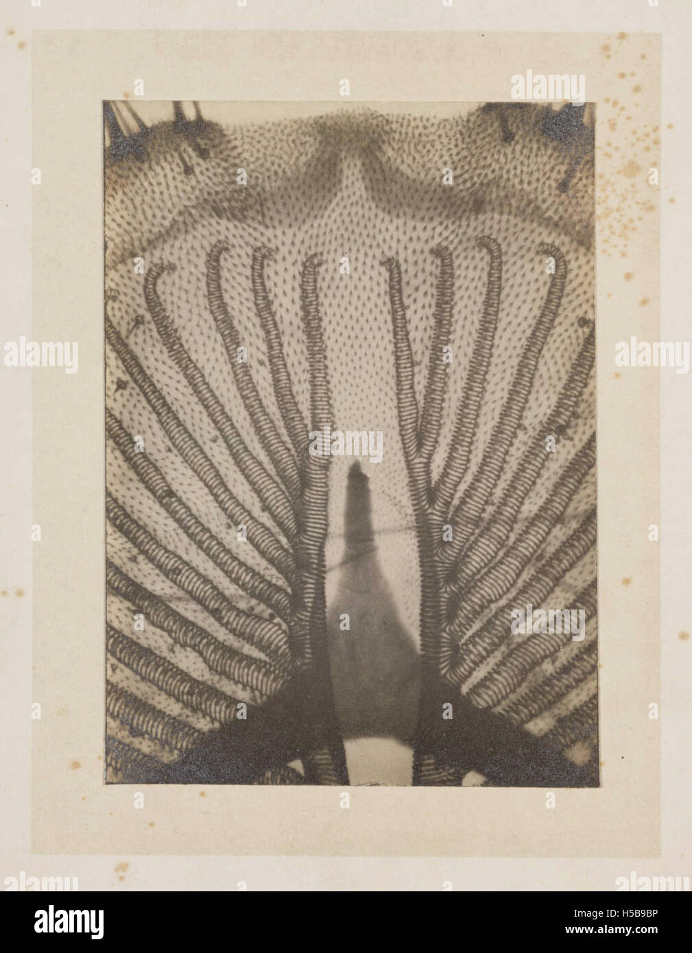 This is a highly magnified image of the sucking tube on the tongue of a ...