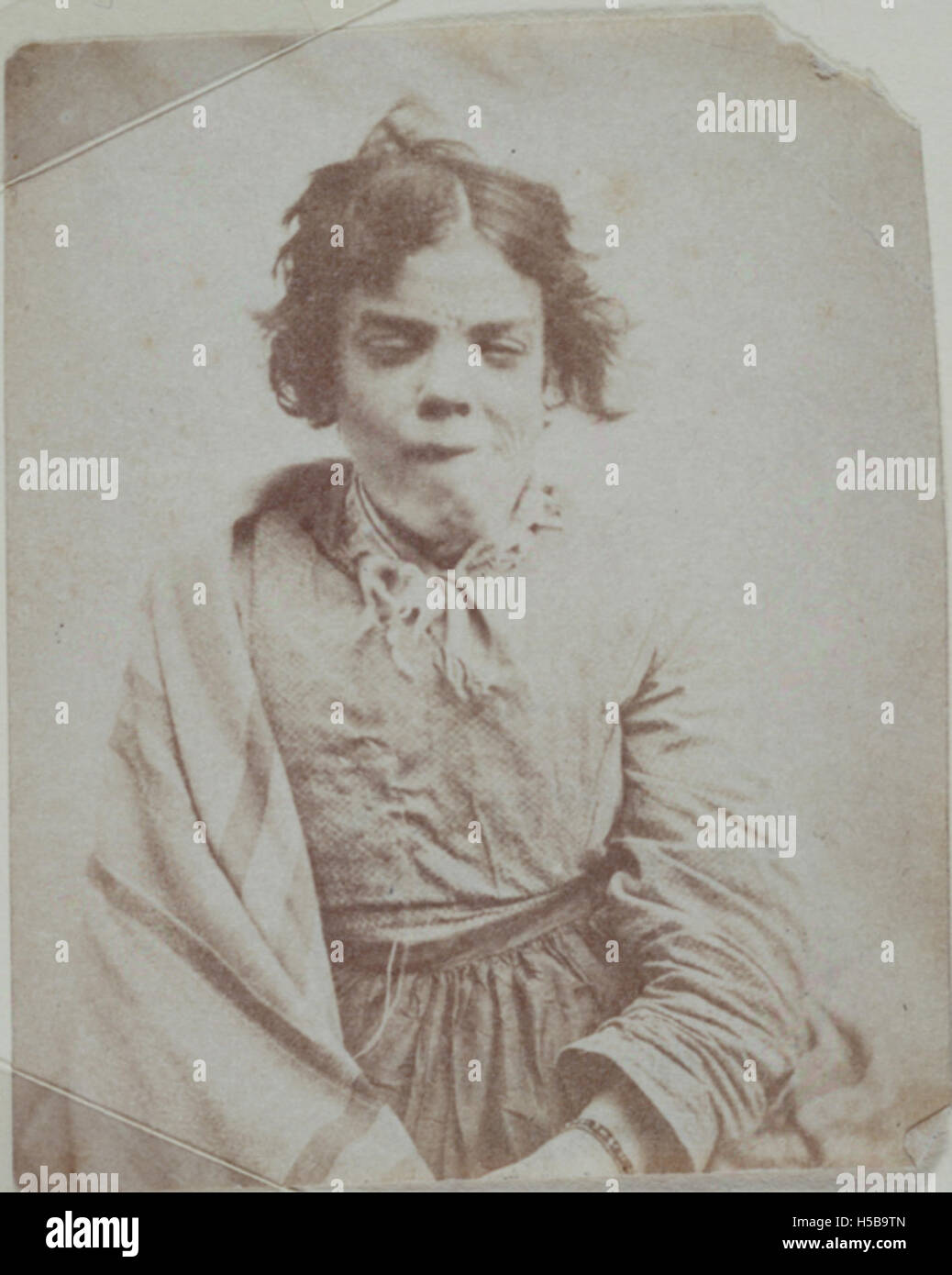 This image is a portrait of a patient from Surrey County Asylum ...