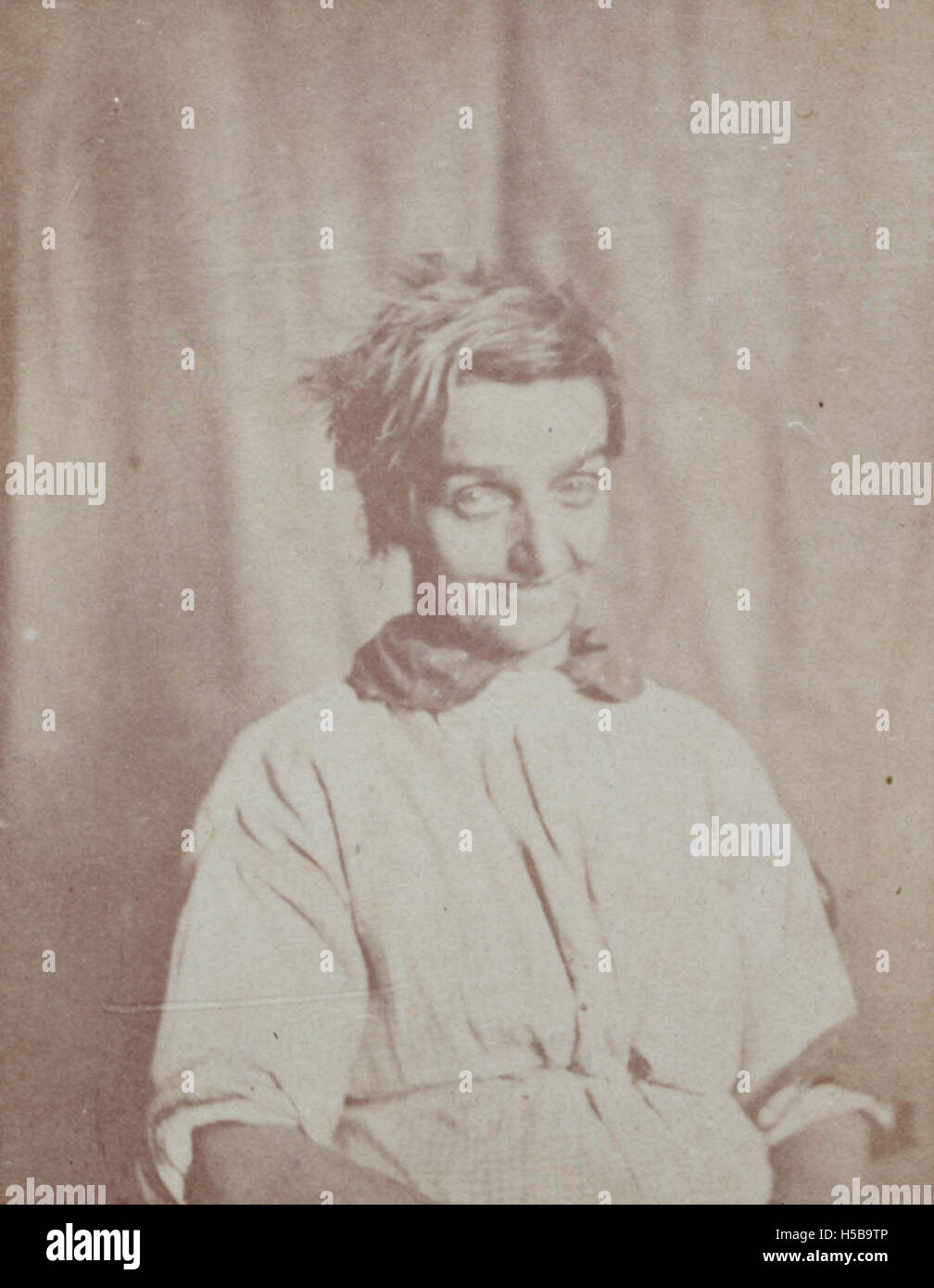 This portrait features a patient from the Surrey County Asylum, likely ...