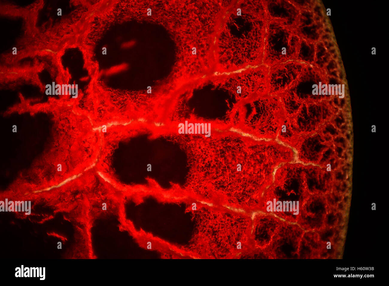 A drop of blood under a microscrope Stock Photo - Alamy