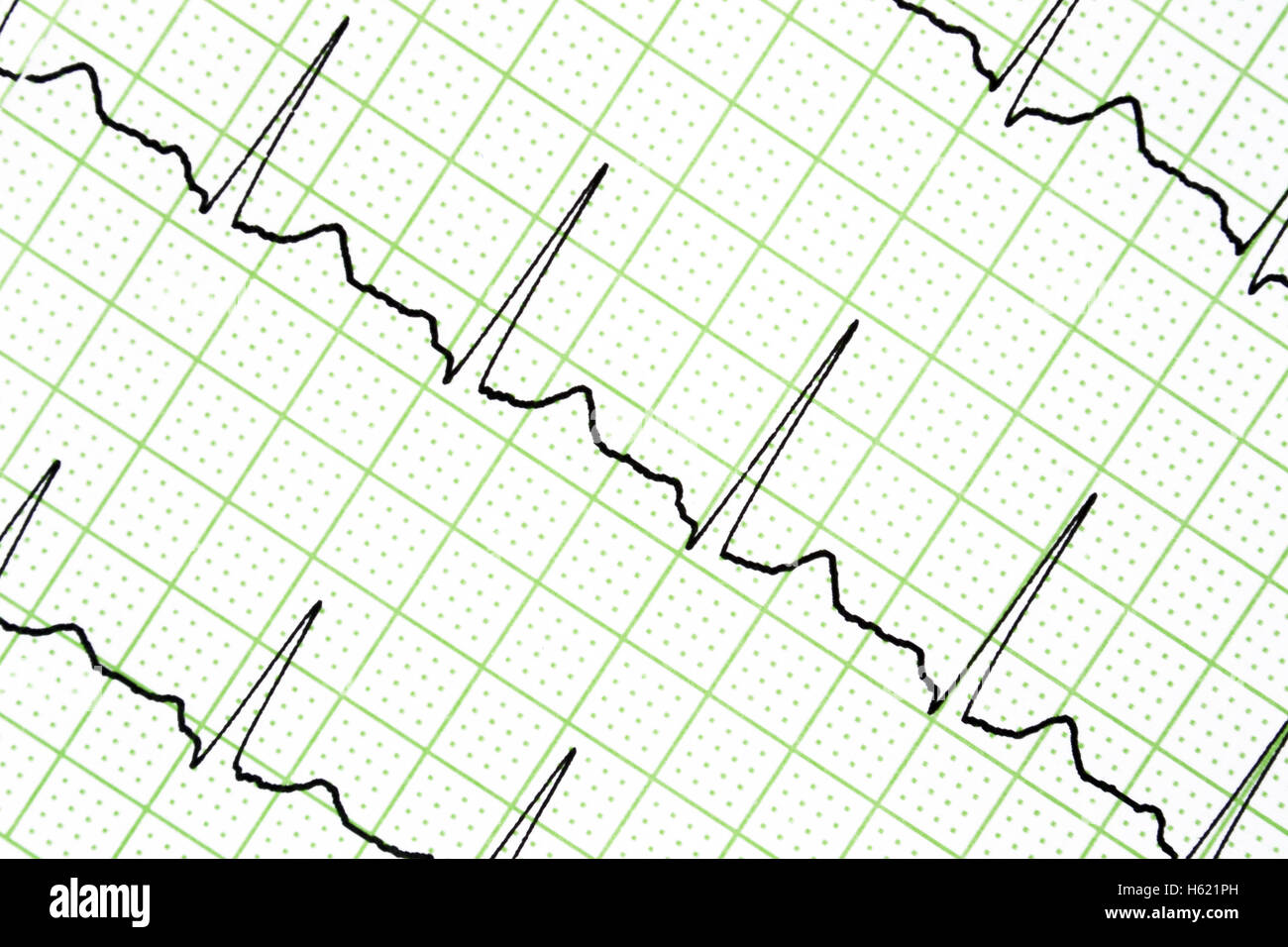Electrocardiogram test hi-res stock photography and images - Alamy
