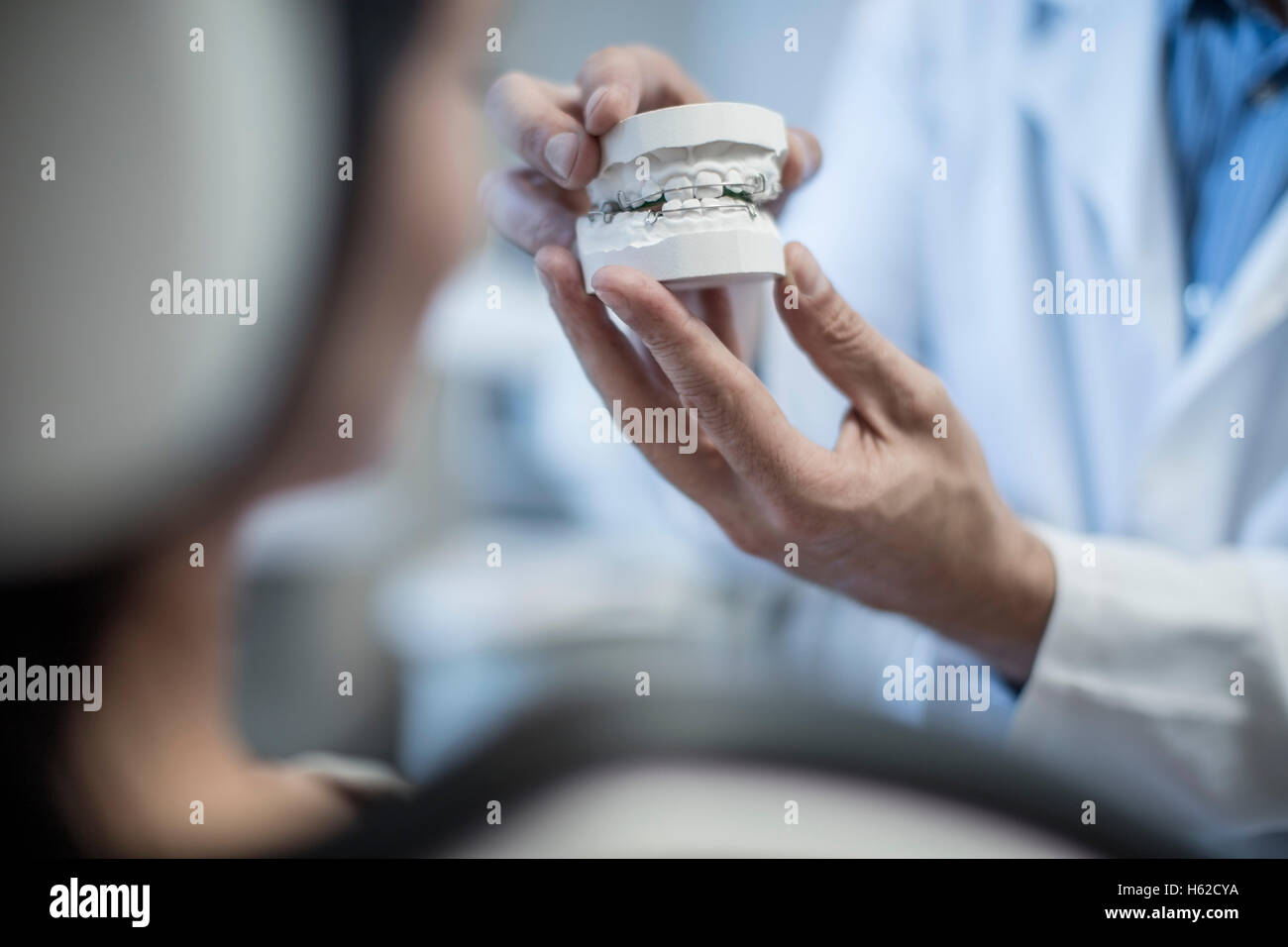 Orthodontist showing patient dental mold Stock Photo - Alamy