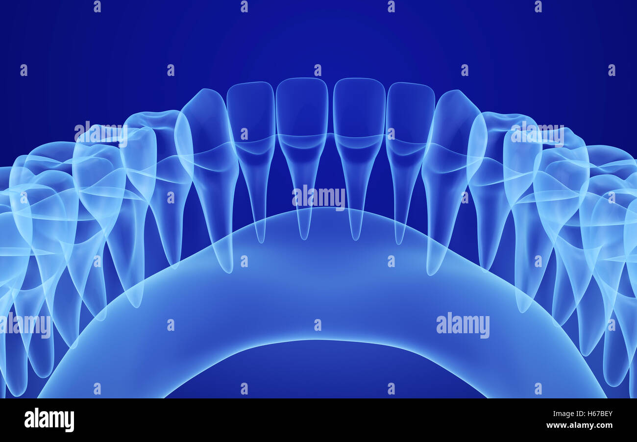 Human teeth xray hi-res stock photography and images - Alamy