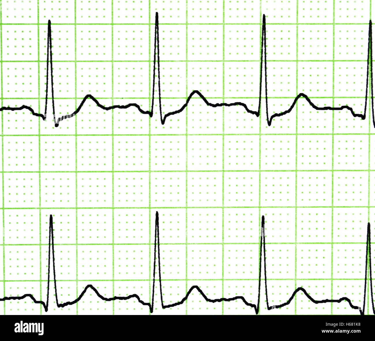 Electrocardiogram test hi-res stock photography and images - Alamy