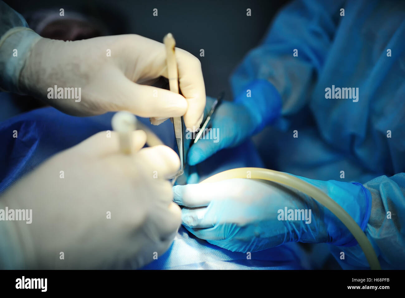 surgeons do surgery Stock Photo - Alamy