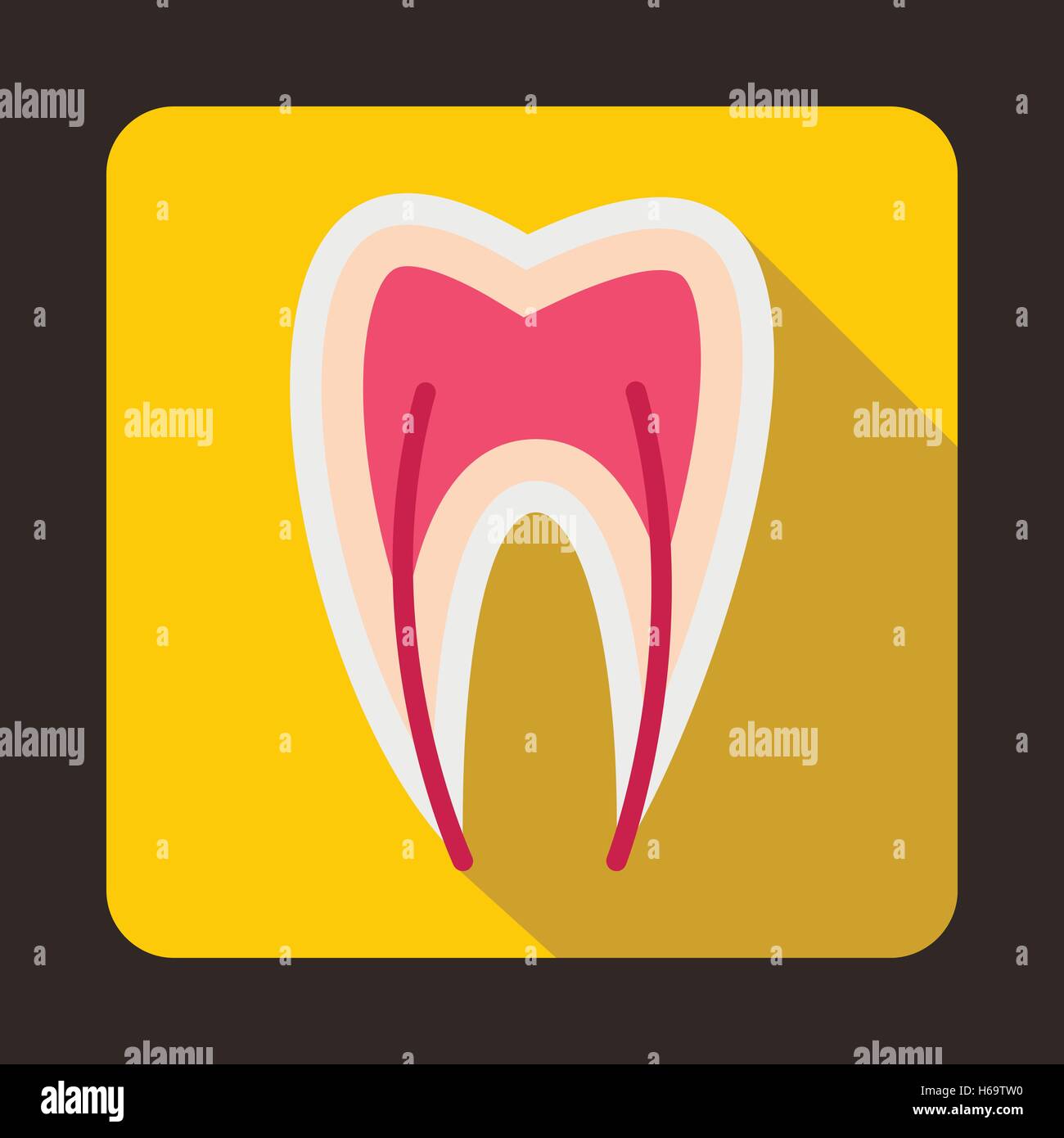 Dental caries cross section hi-res stock photography and images - Alamy