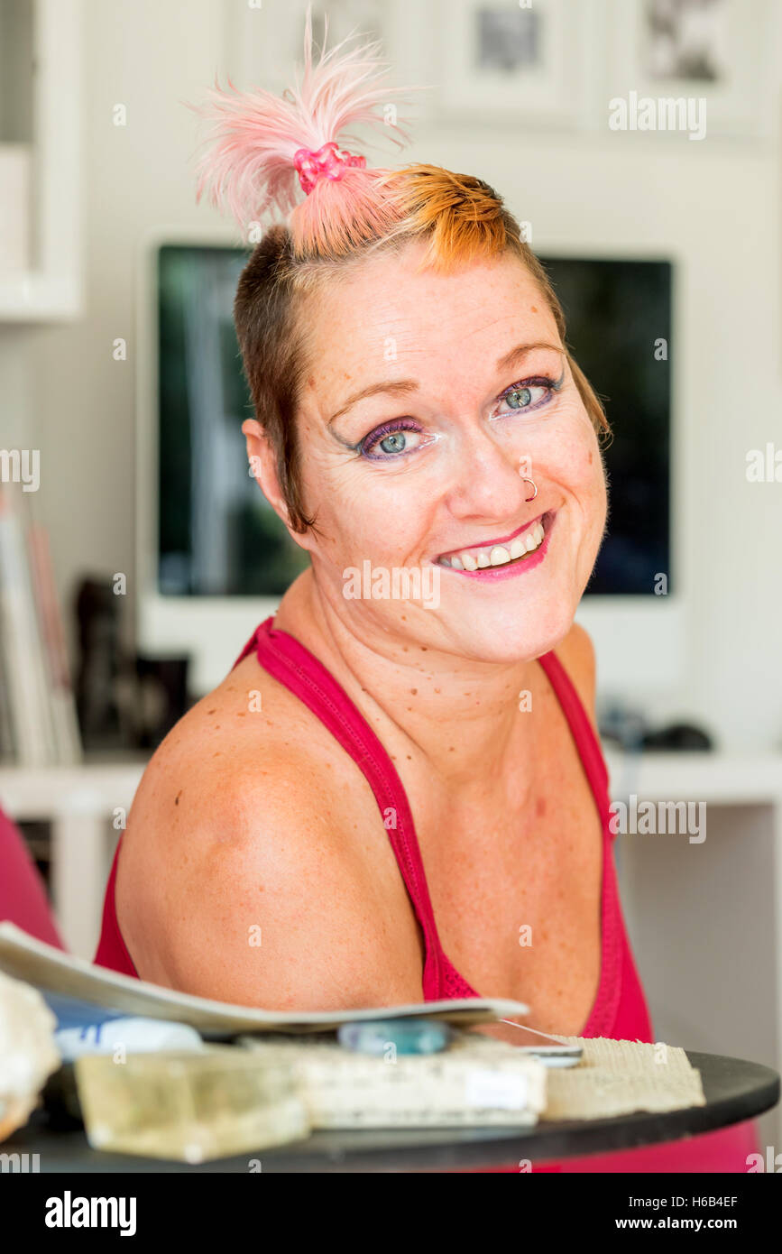 Phocomelia hi-res stock photography and images - Alamy