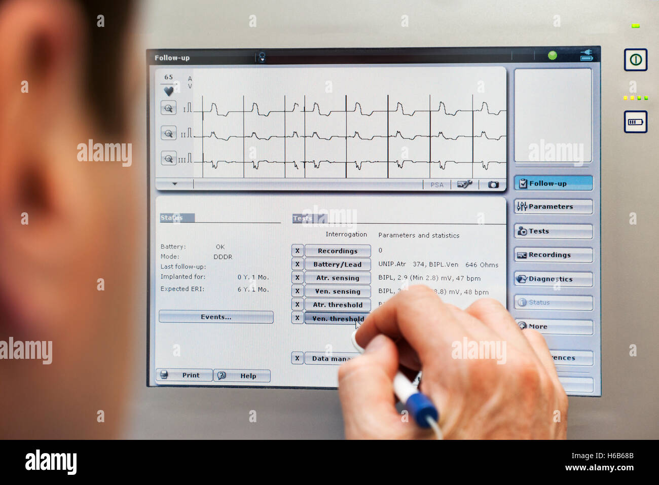 Pacemaker and heart hi-res stock photography and images - Alamy