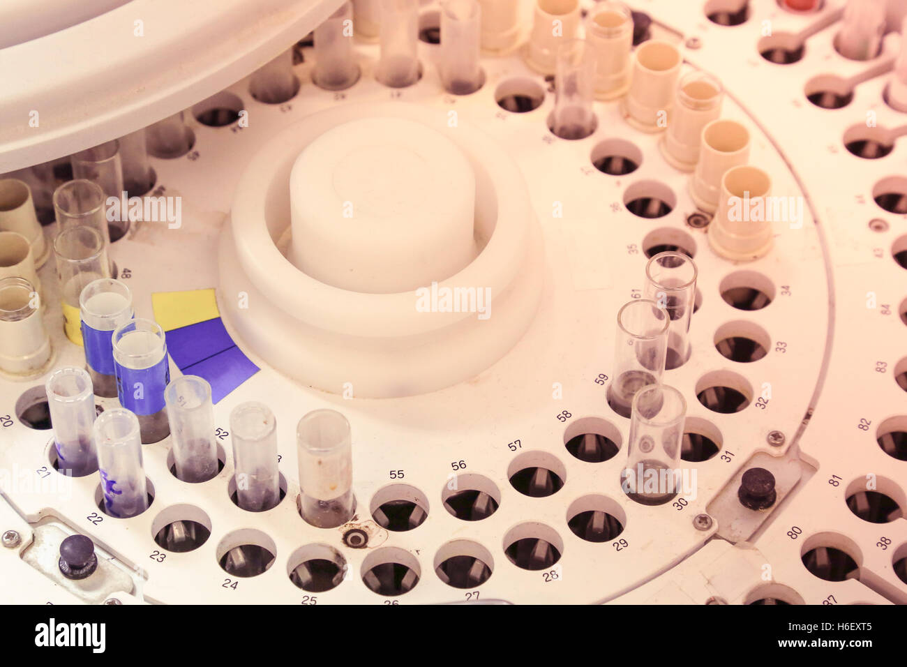 Blood chemistry analyzer hi-res stock photography and images - Alamy