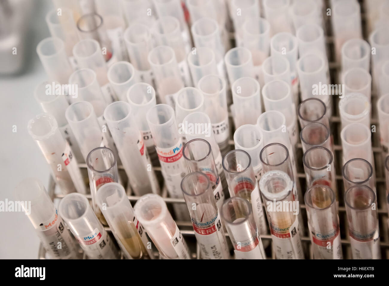 Centrifuge blood hi-res stock photography and images - Alamy