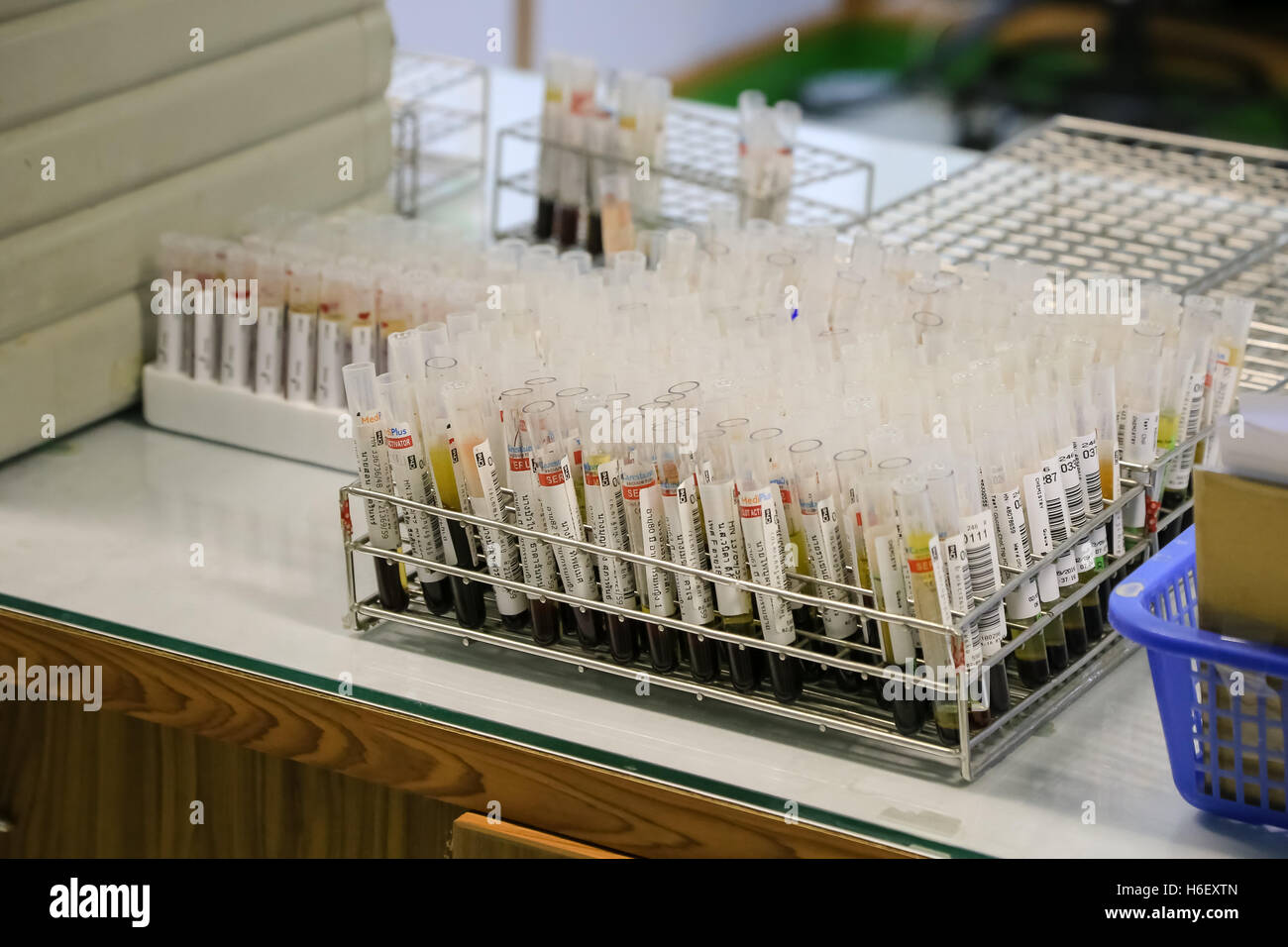 Blood samples in blood collection hi-res stock photography and images ...