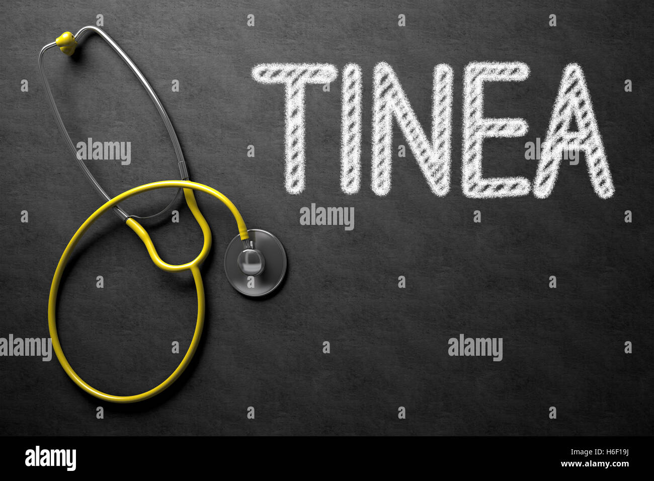 Chalkboard with Tinea Concept. 3D Illustration Stock Photo - Alamy