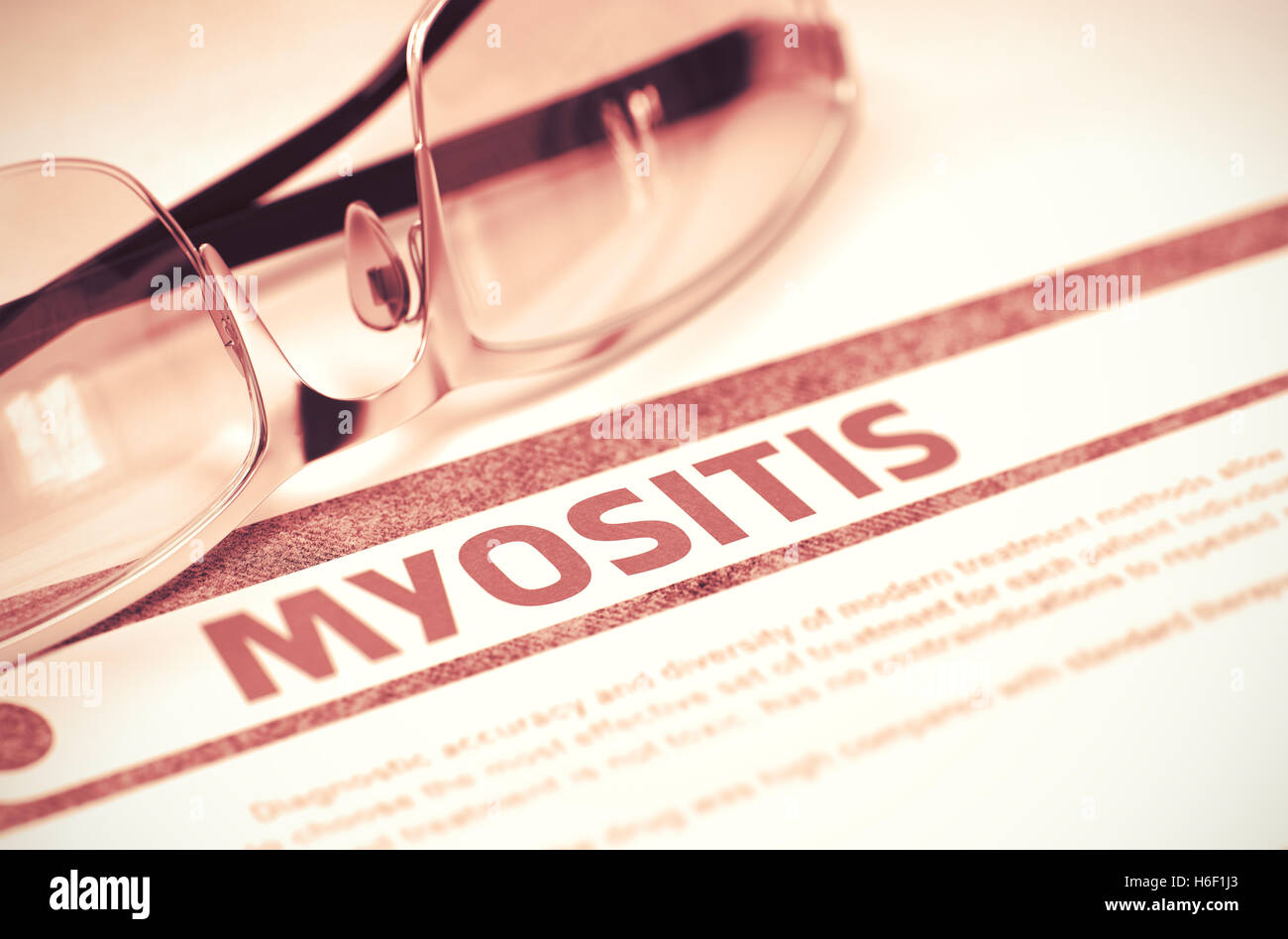 Diagnosis - Myositis. Medical Concept. 3D Illustration Stock Photo - Alamy
