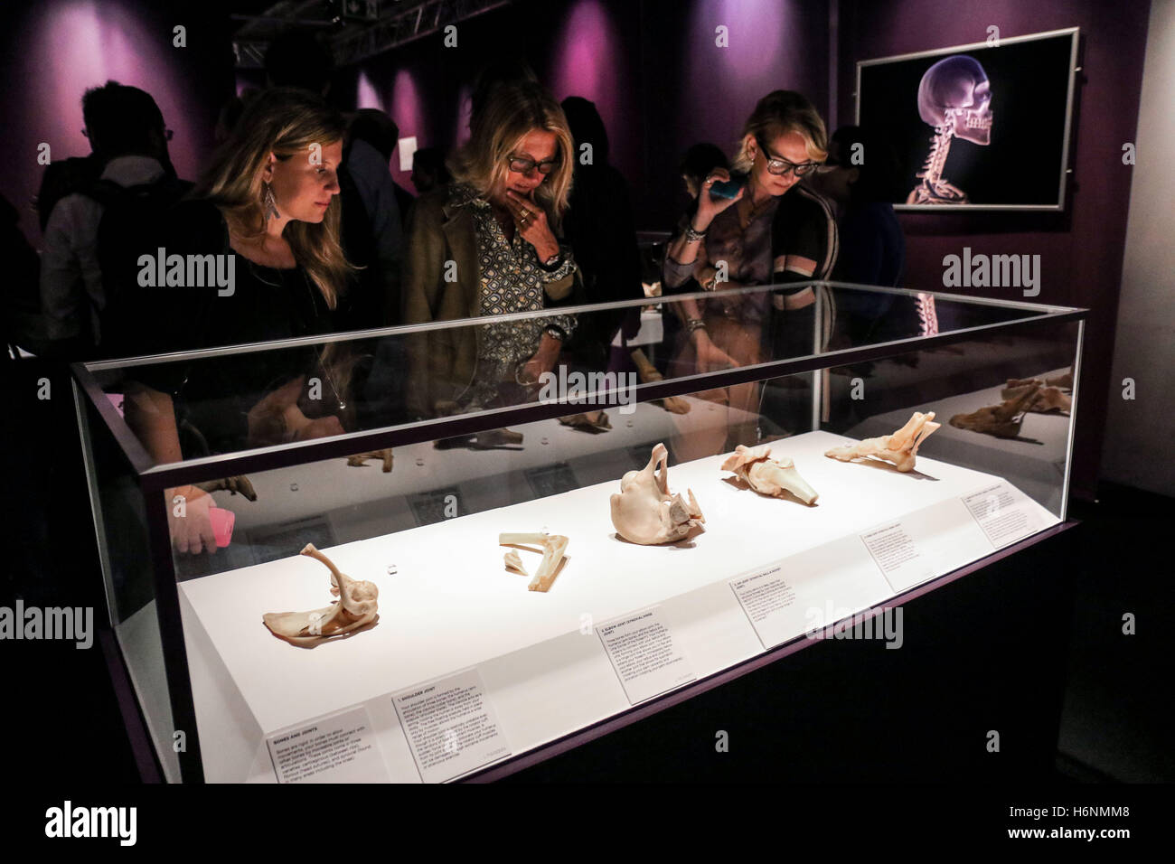 ‘Real Bodies’ a Discovery of the Human Body Exhibition in Milan ...