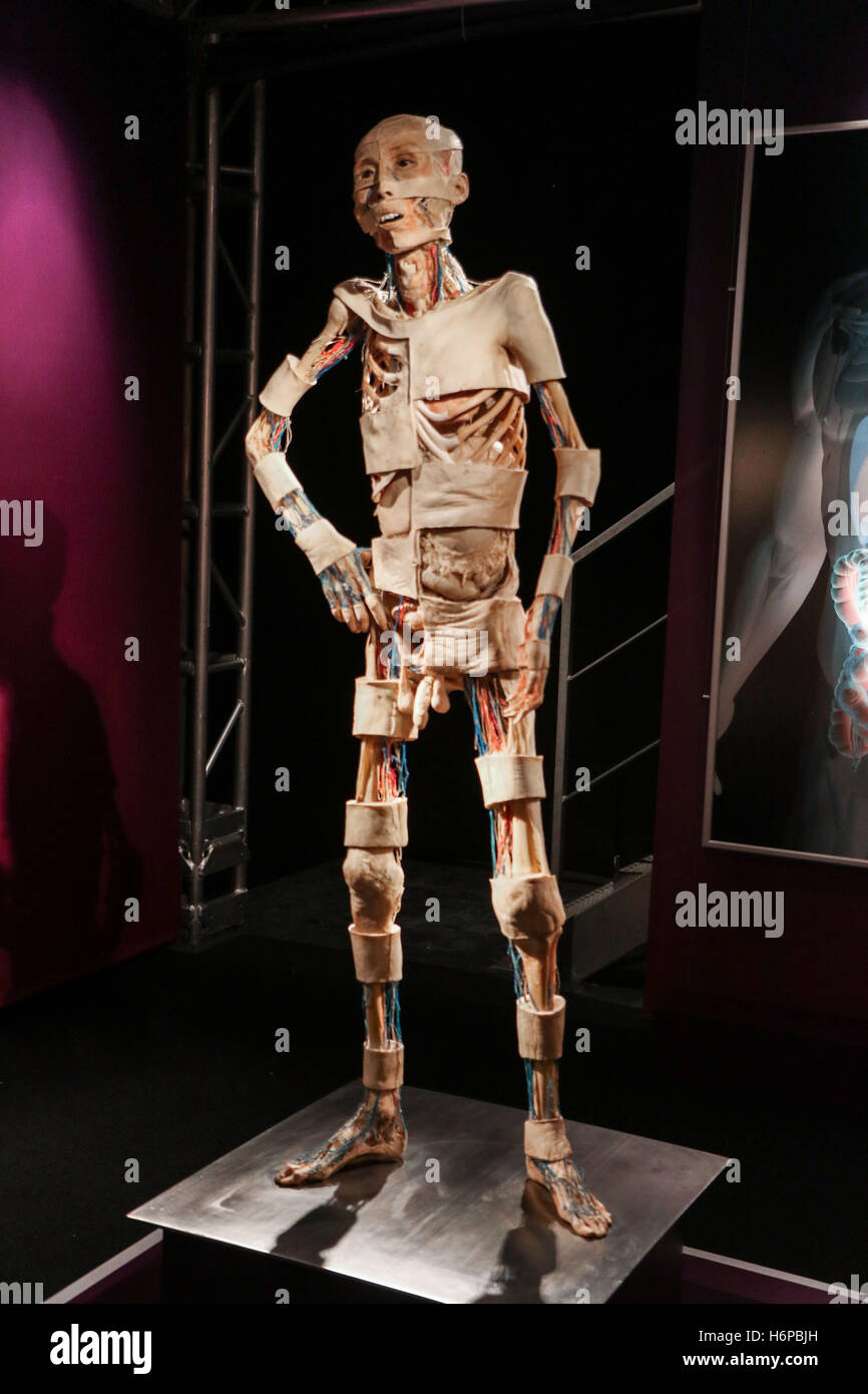 ‘Real Bodies’ a Discovery of the Human Body Exhibition in Milan ...