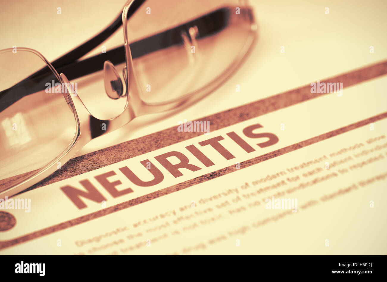 Diagnosis - Neuritis. Medicine Concept. 3D Illustration Stock Photo - Alamy