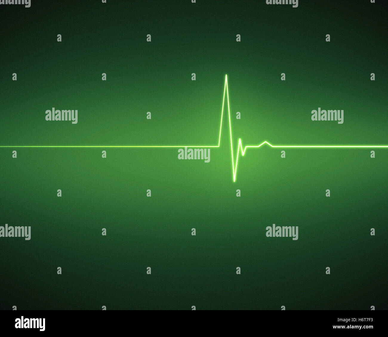 Green ecg hi-res stock photography and images - Alamy